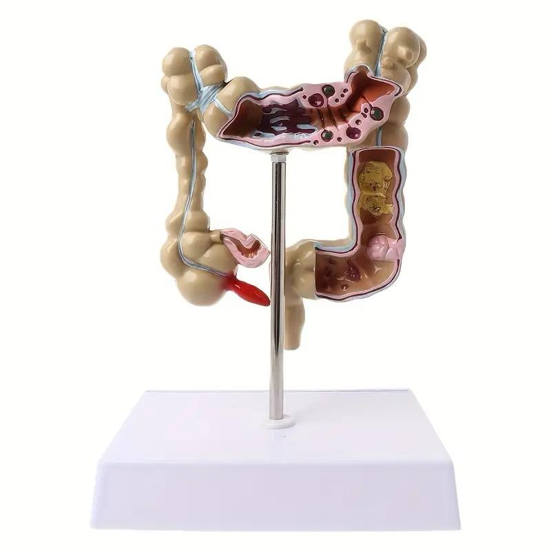 MODELO ANATÓMICO DEL COLON – DOCTOR DRESS PANAMA